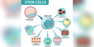 How Long Does Stem Cell Treatment Take to Work? Timelines & Expectations